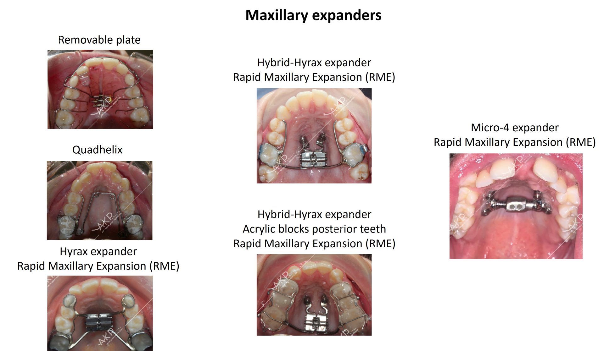 Orthodontic Appliances - AKP